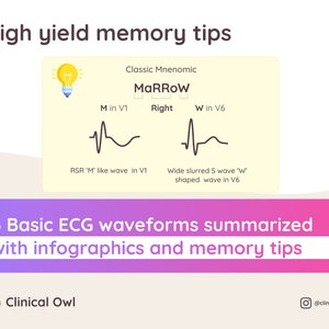 ECG Essentials | Last Minute Study Notes for Nursing, Medical, Pharmacy ...
