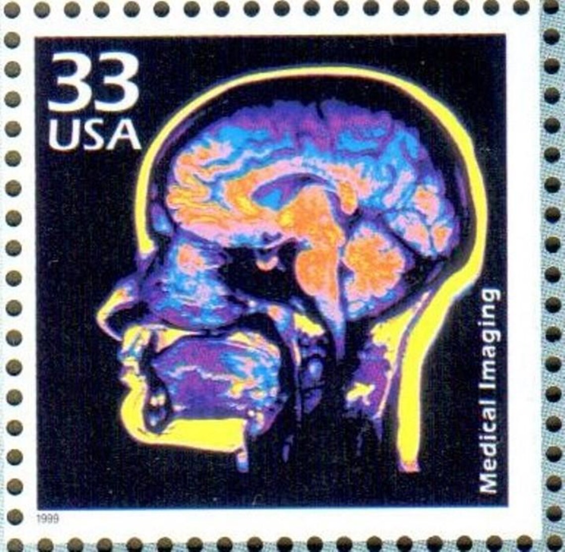 Vintage Unused Medical Imaging CAT Scans Mri Technology Advancements 33 ...