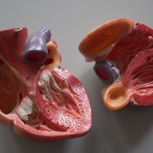 Vintage HUMAN TORSO Somso Educational Model - Etsy