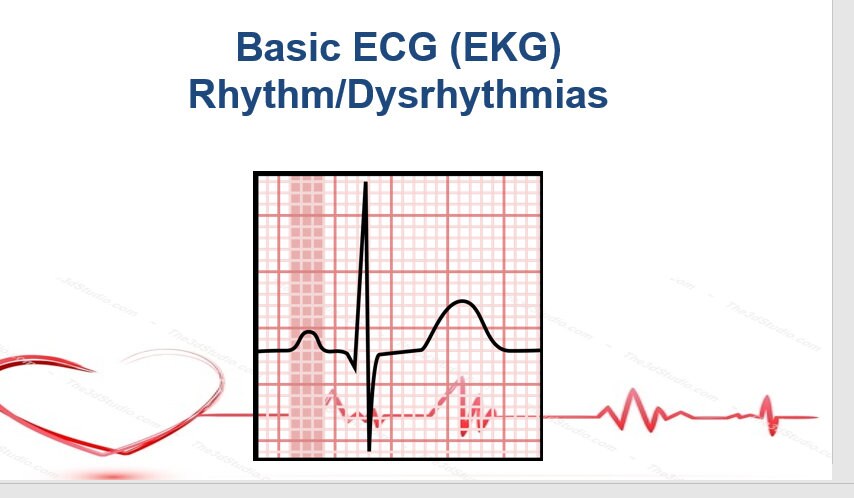 Basic Ekg Rhythms