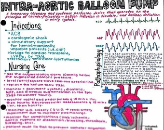 Intra Aortic Balloon Pump Cheat Sheet - Etsy