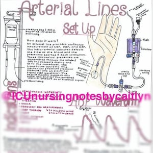 Arterial Line Set Up