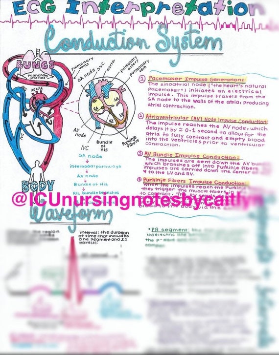 Basics of ECG Interpretation - Etsy