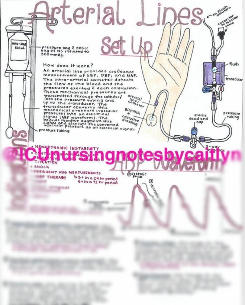 Arterial Lines Nursing Study Sheet - Etsy