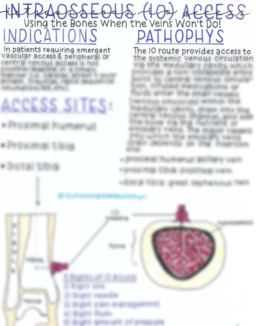 Intraosseous (IO) Access - Etsy