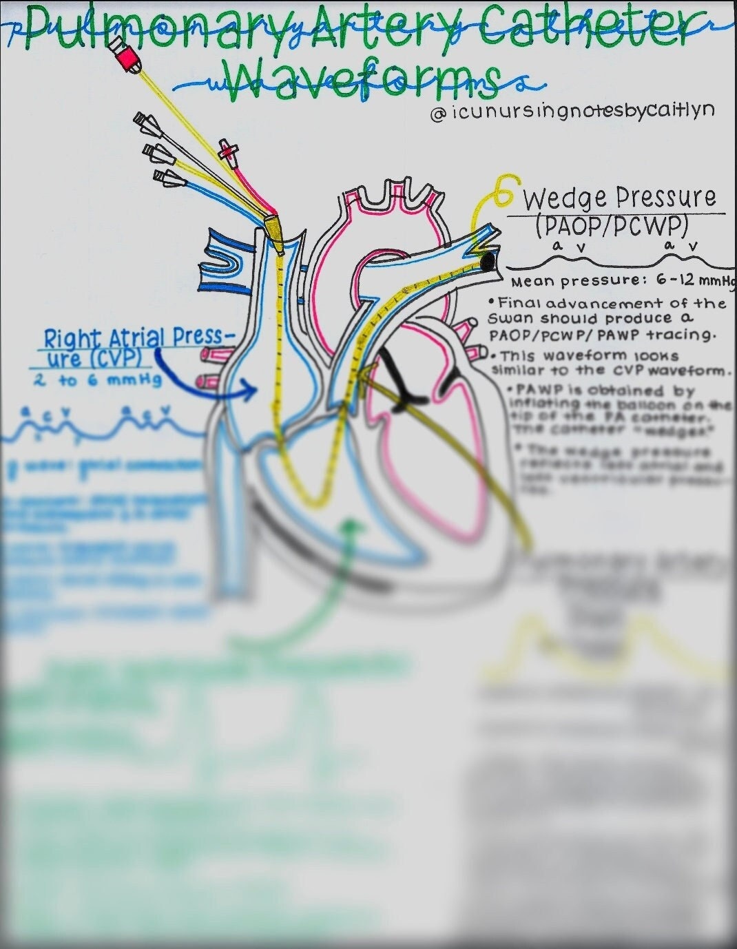 Pulmonary Artery Catheter Waveforms