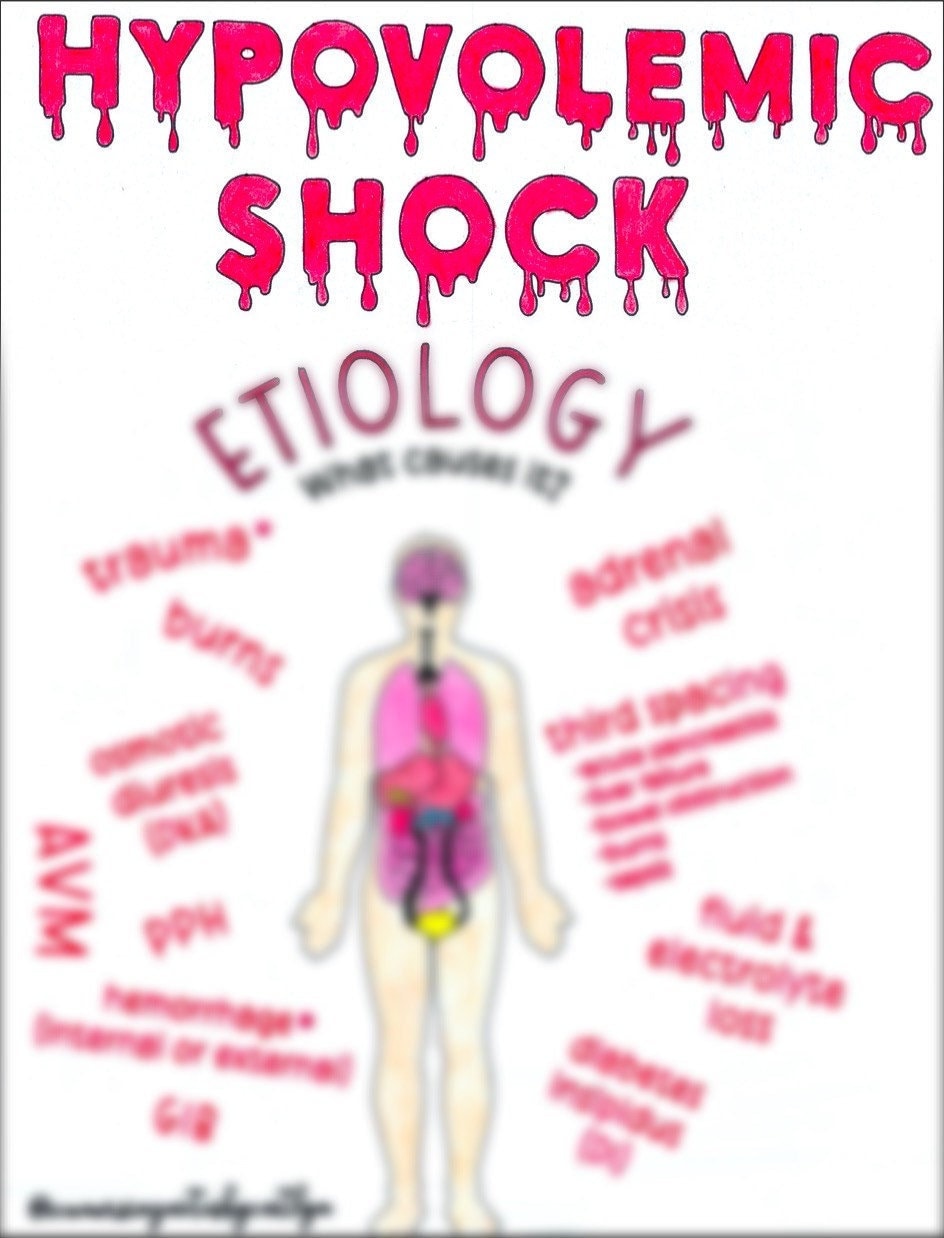 Hypovolemic Shock