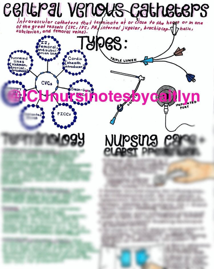 Central Lines - Etsy