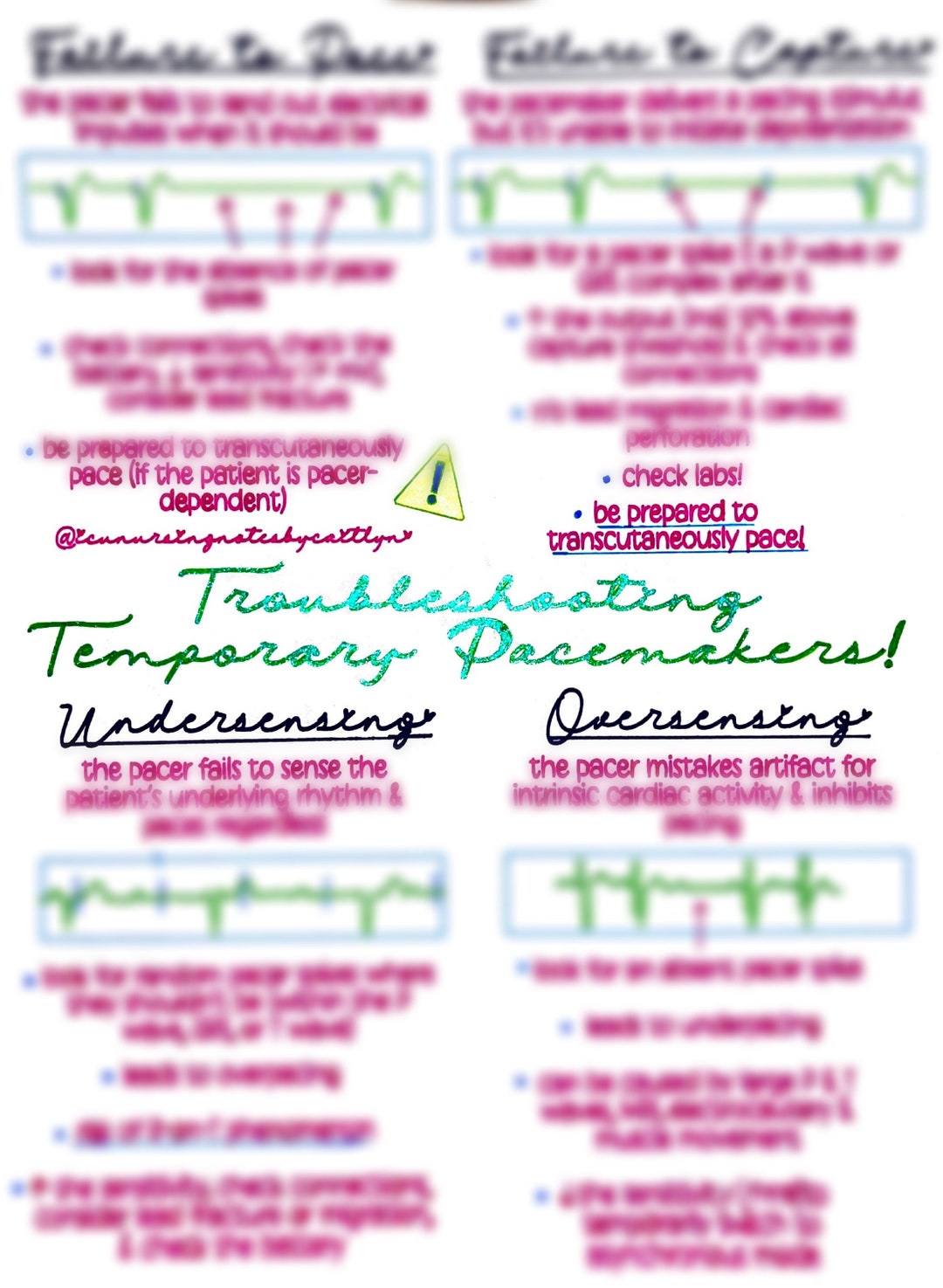 Troubleshooting Transvenous Pacemakers (tvps) - Etsy