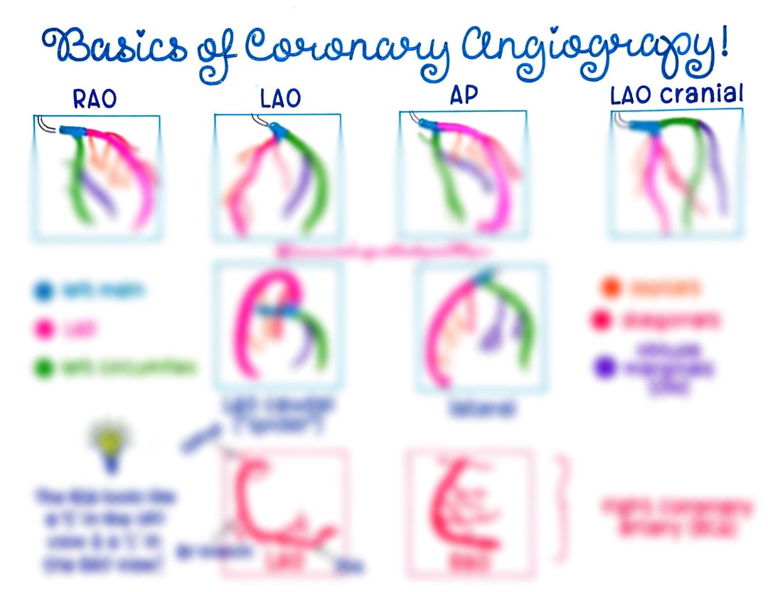 Basics of Coronary Angiography - Gel Pens - Etsy