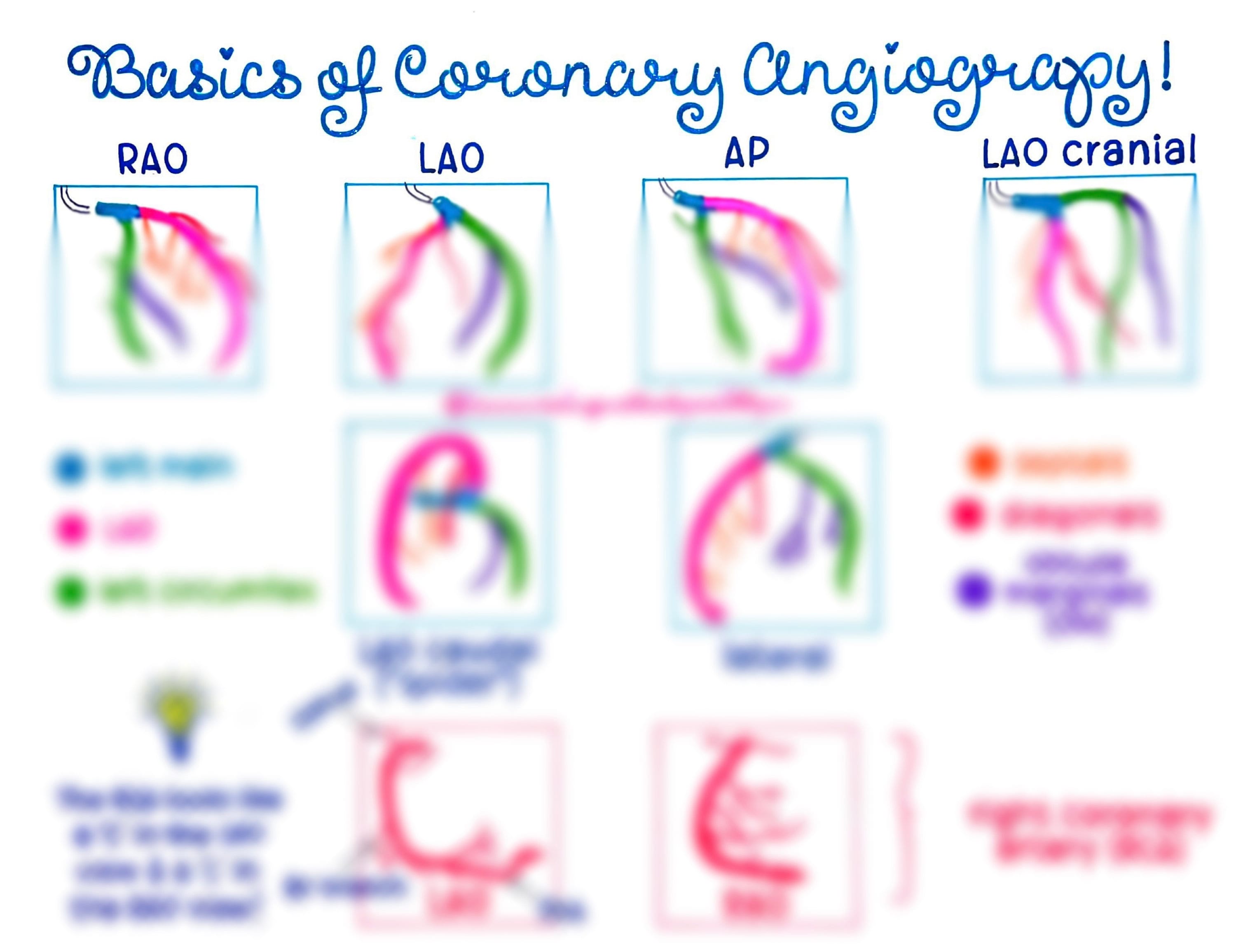 Basics of Coronary Angiography - Gel Pens - Etsy