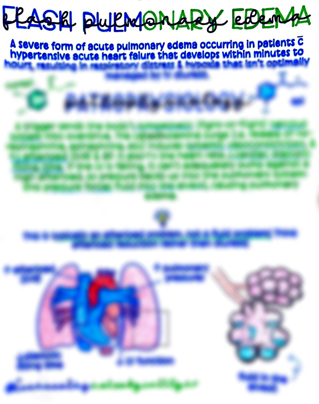 Flash Pulmonary Edema/scape - Etsy