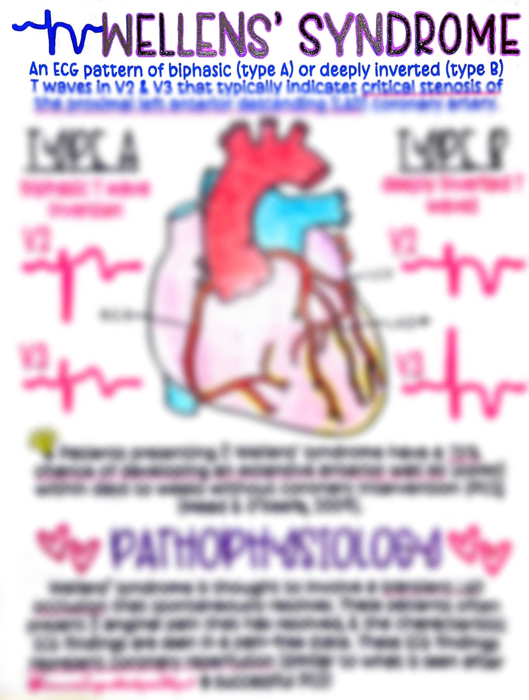 Wellens' Syndrome - Etsy