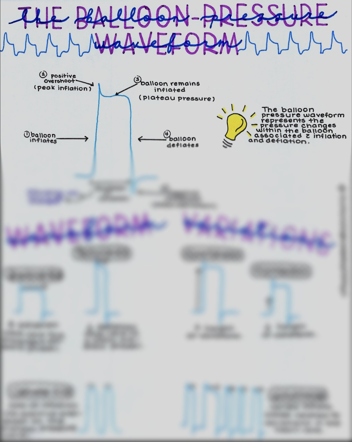 Intra-aortic Balloon Pump IABP Waveforms - Etsy Finland