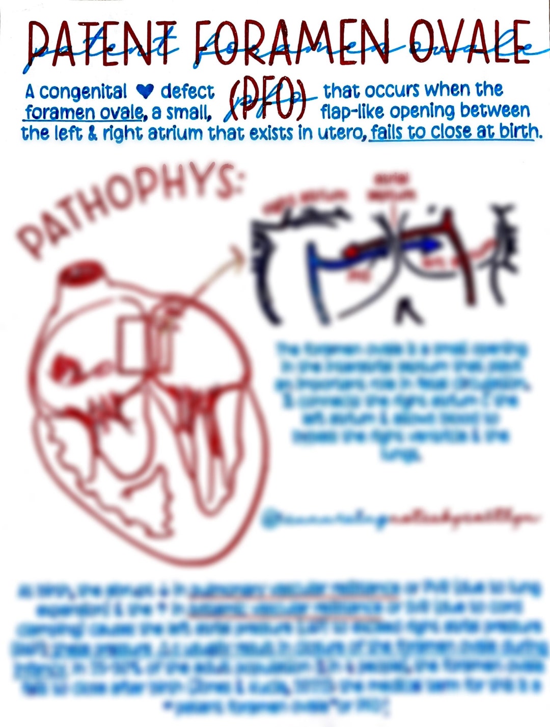 Patent Foramen Ovale Pfo Etsy