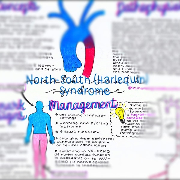 North South Syndrome - Etsy