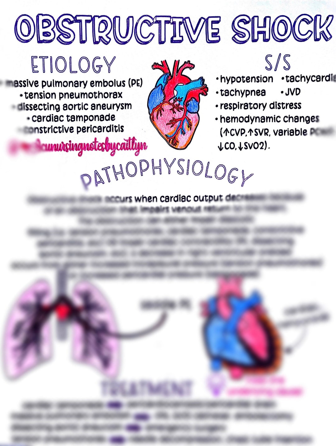 Obstructive Shock - Etsy