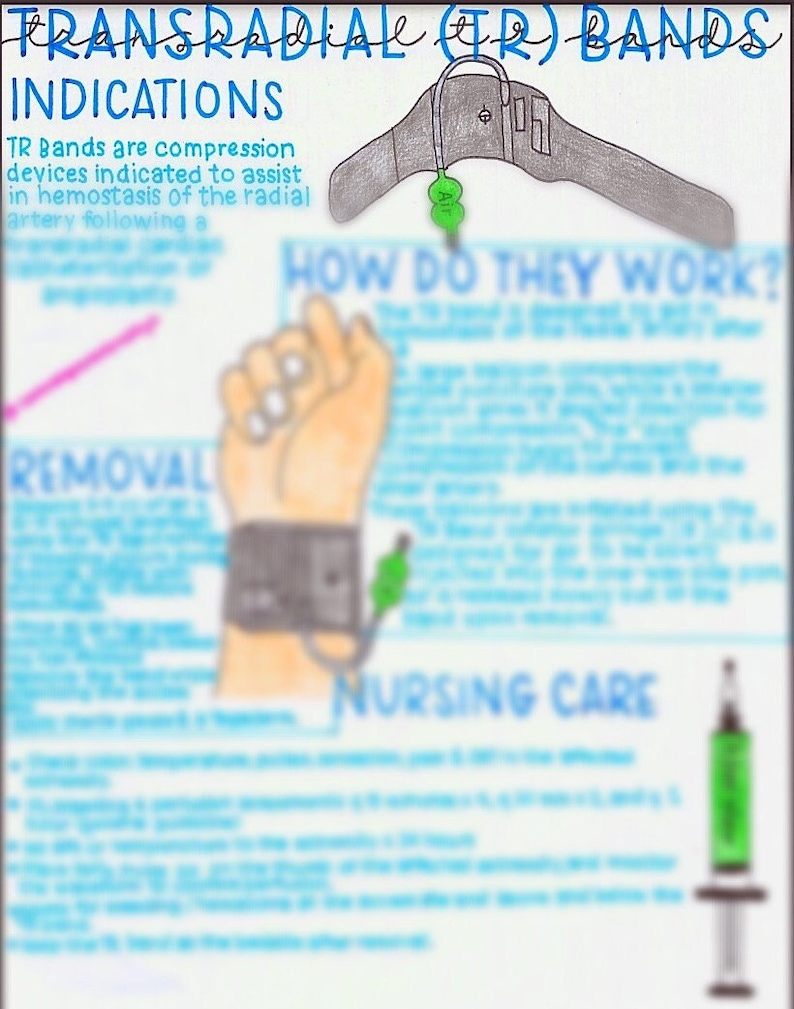 Transradial (TR) Bands - Etsy