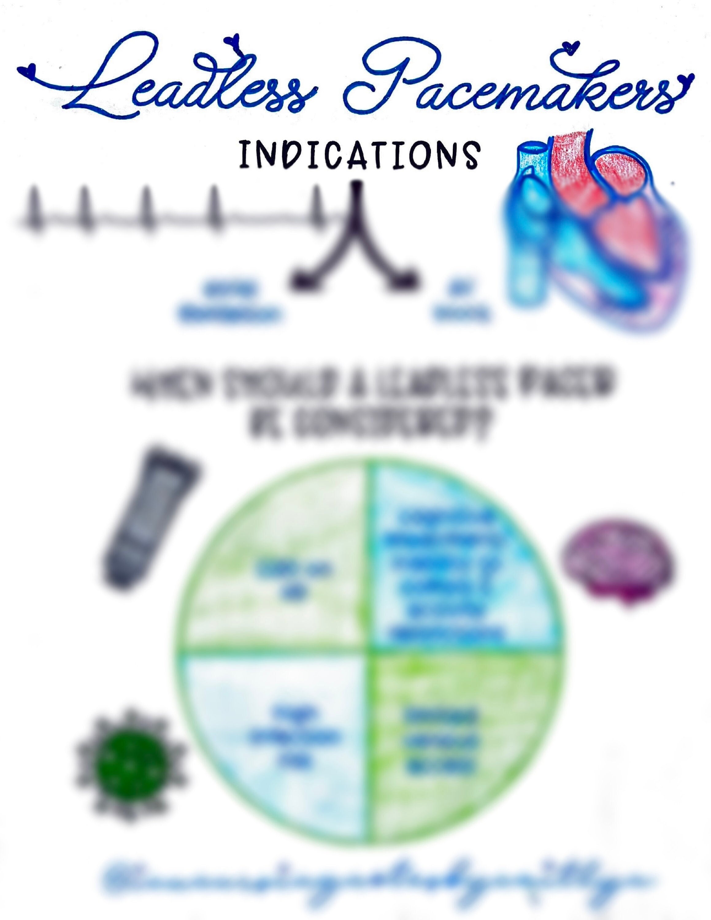 Leadless Pacemaker (micra) - Etsy