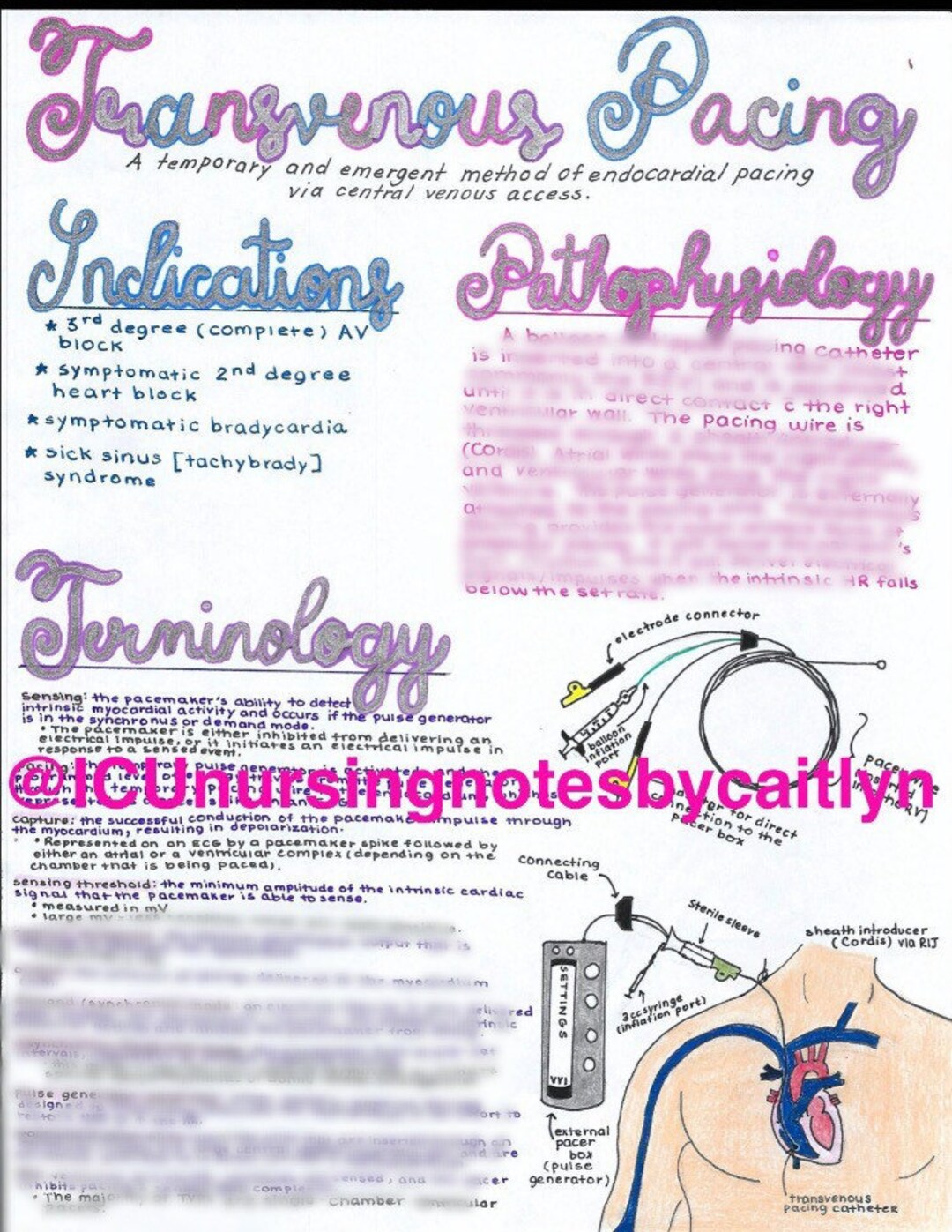 Transvenous Pacing TVP - Etsy