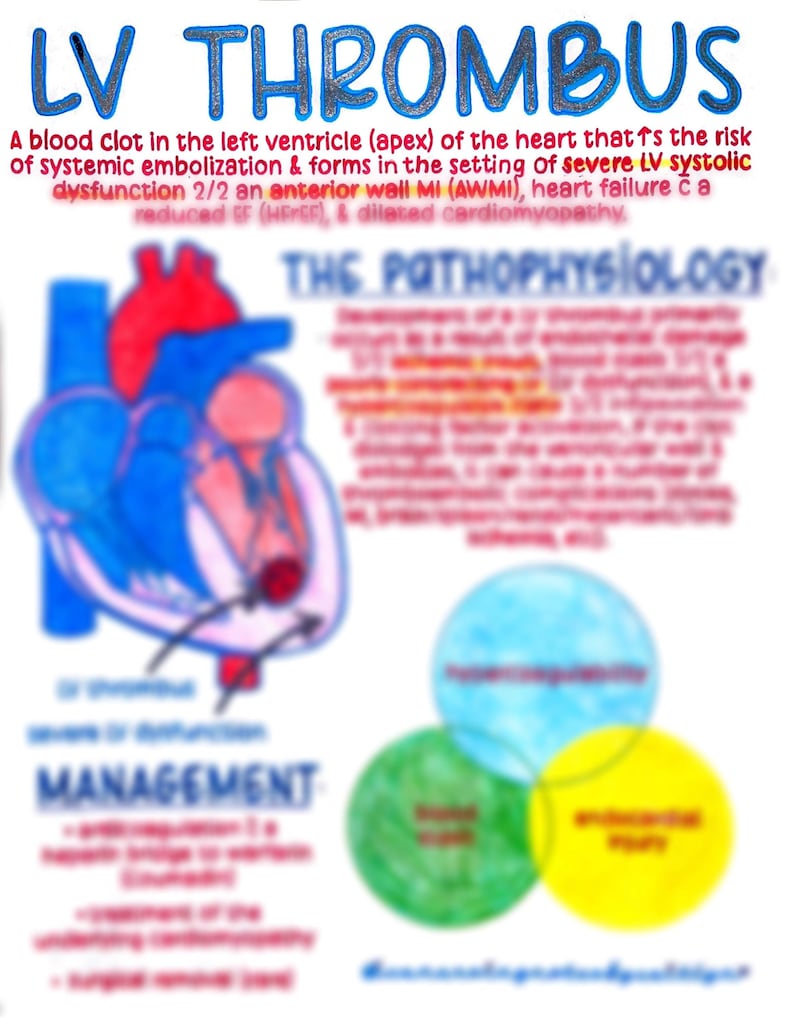 Left Ventricular (LV) Thrombus - Etsy