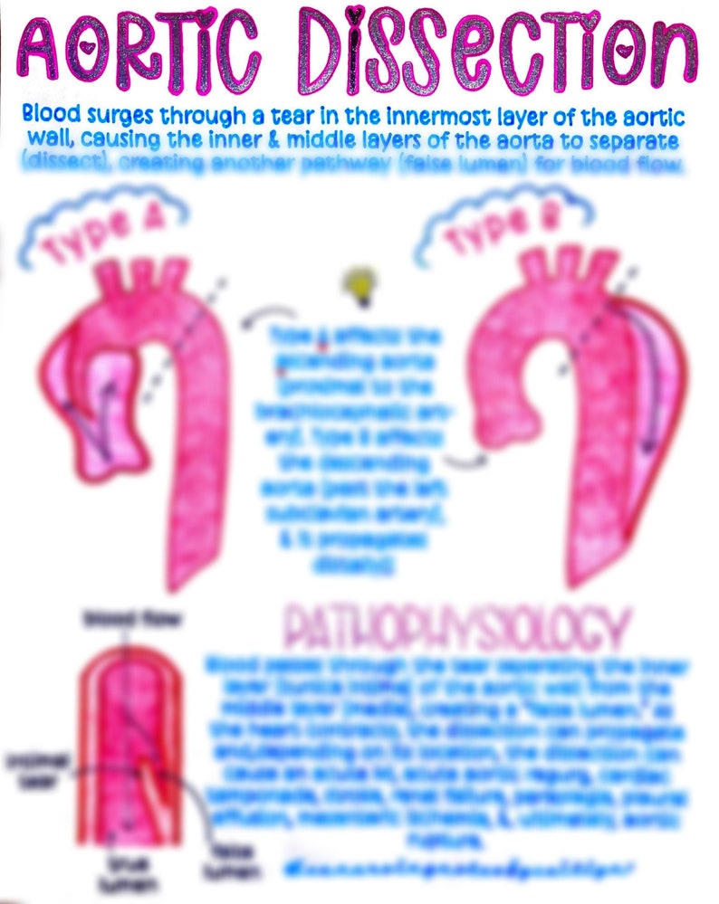 Aortic Dissection: the Pathophysiology - Etsy