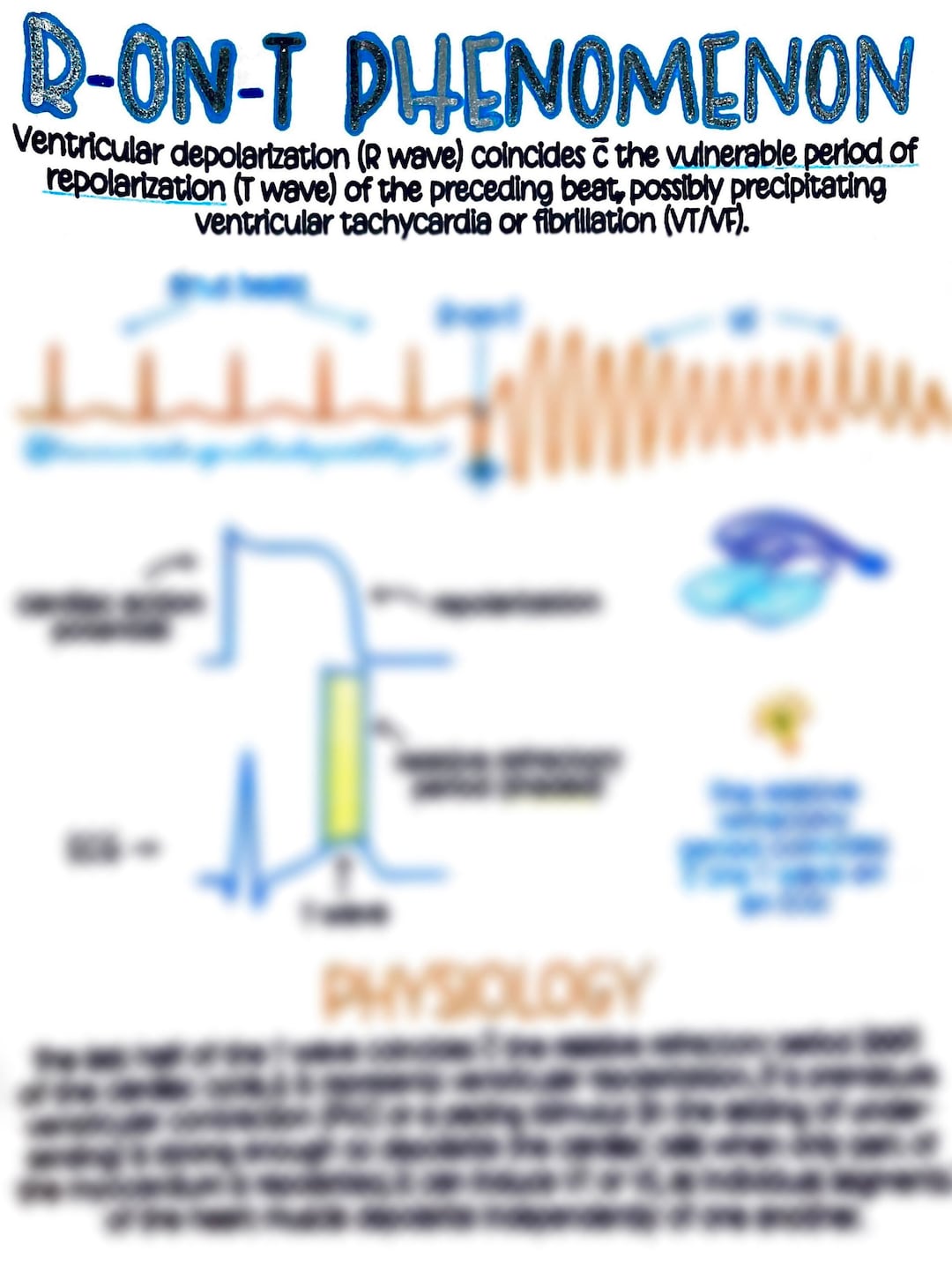 R-on-t Phenomenon - Etsy