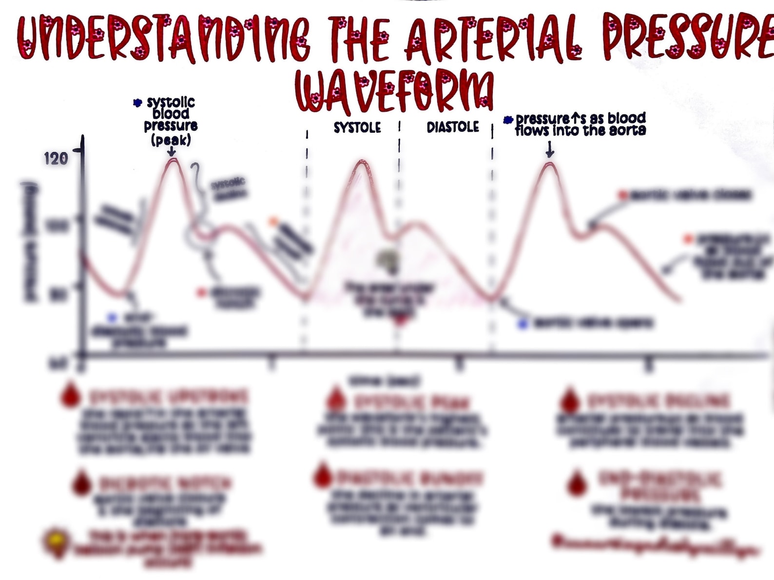 The Arterial Line (ABP) Waveform - Etsy