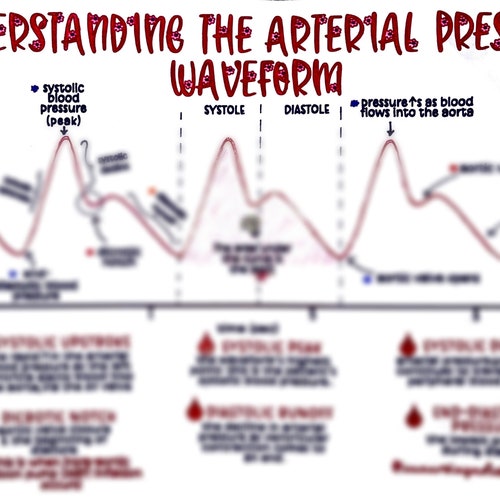 The Arterial Line ABP Waveform - Etsy