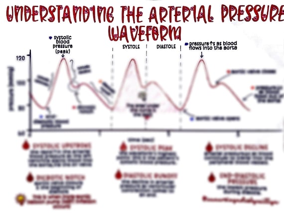 The Arterial Line Abp Waveform Etsy