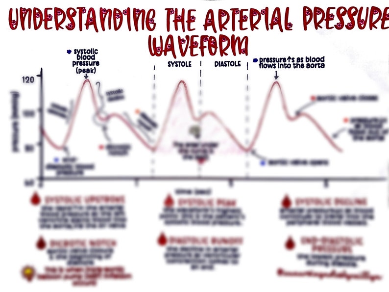 The Arterial Line (ABP) Waveform - Etsy