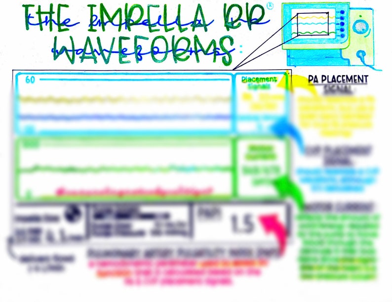 The Impella RP® & Waveforms - Etsy