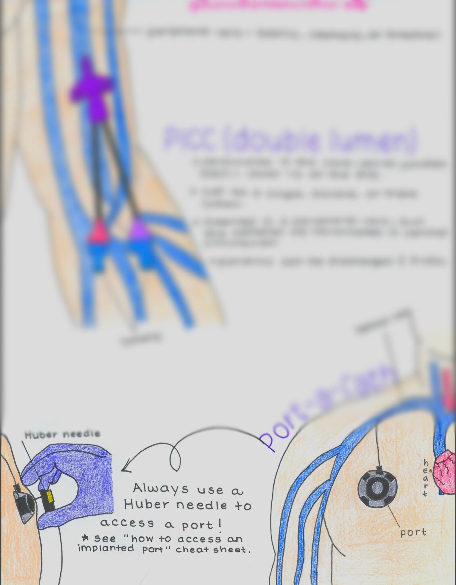 Vascular Access Devices (vads) - Etsy