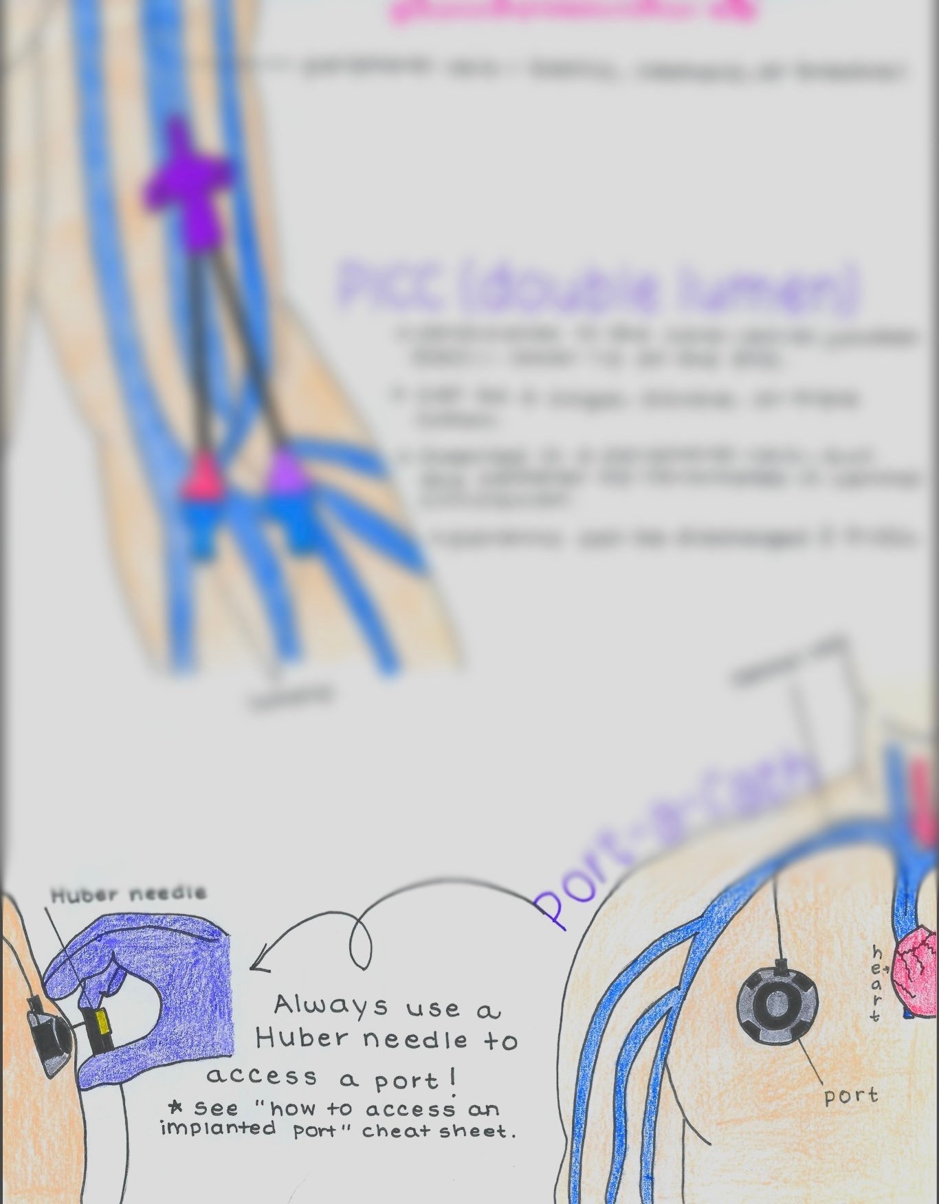 Vascular Access Devices (vads) - Etsy