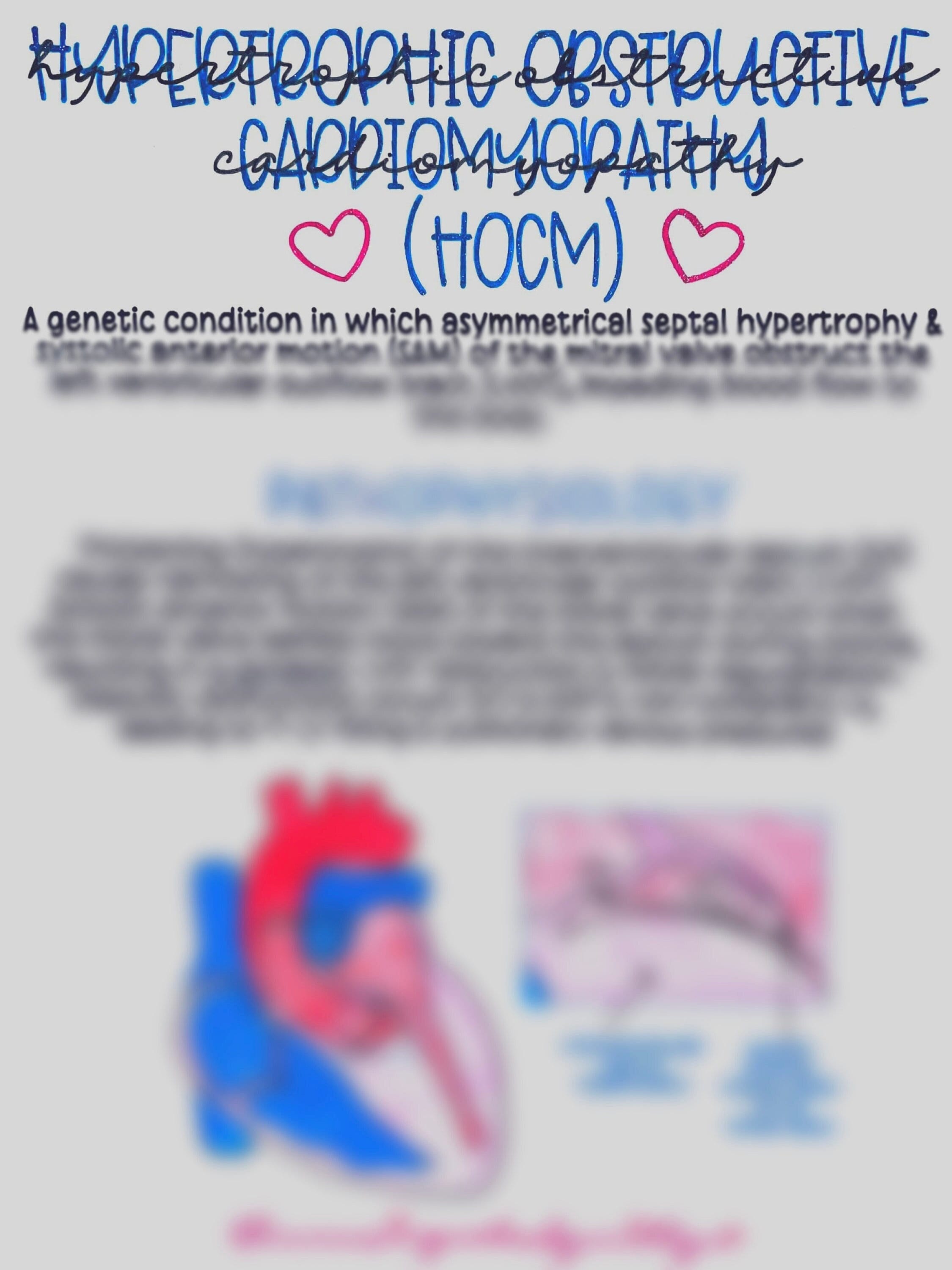 Hypertrophic Obstructive Cardiomyopathy (HOCM) - Etsy