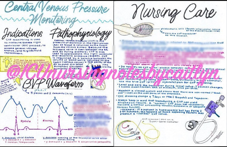 Central Venous Pressure (CVP) Monitoring - Etsy