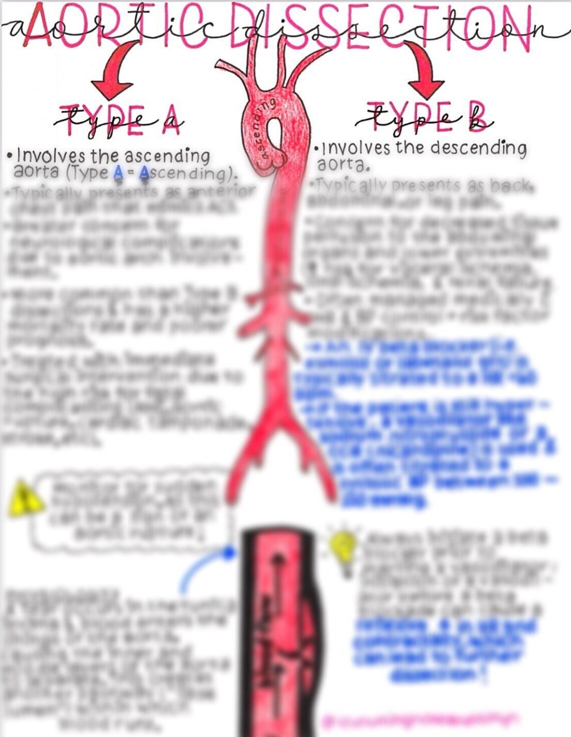 Aortic Dissections: Type A & B - Etsy
