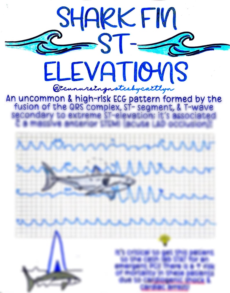 Shark Fin ECG Sign - Etsy