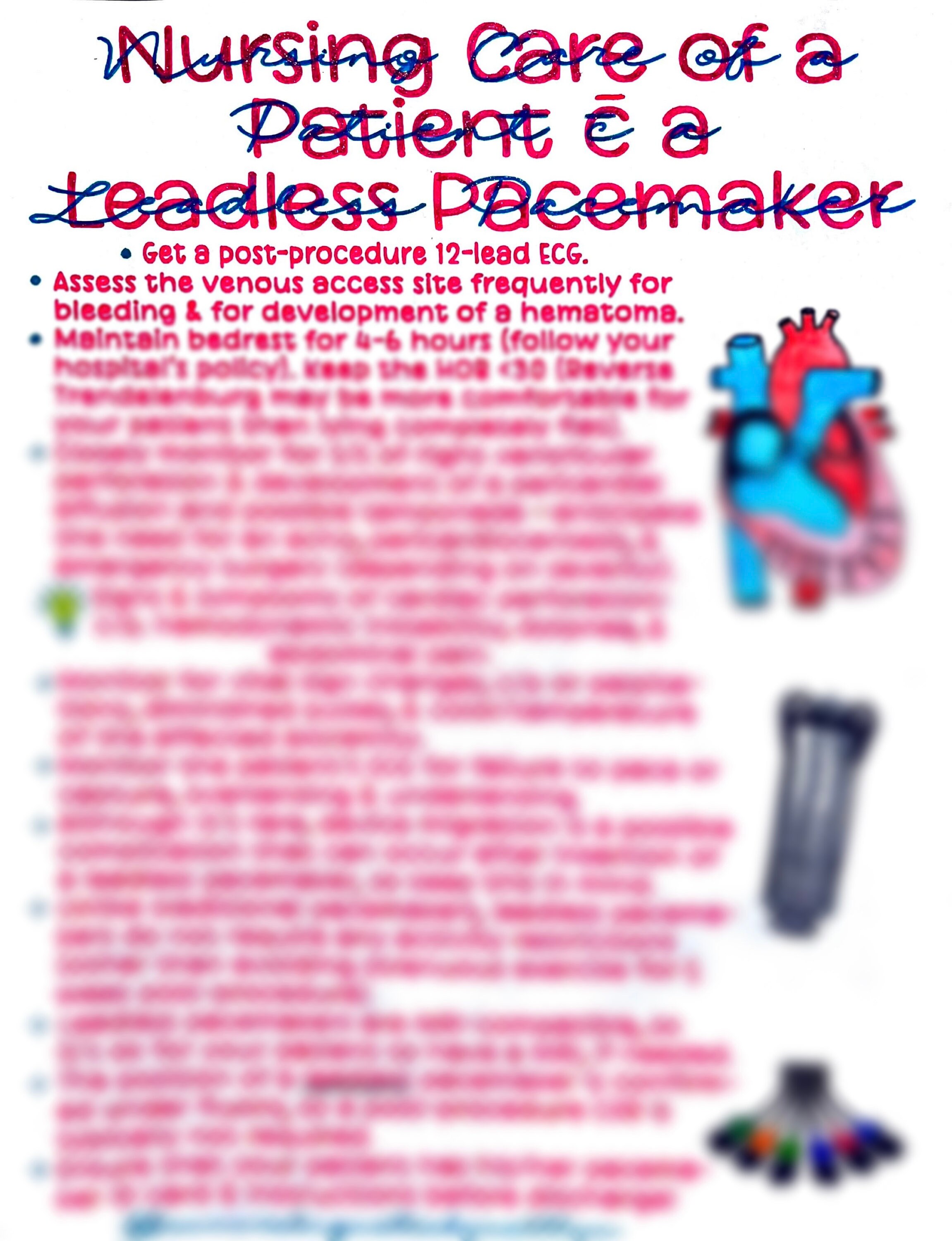 Leadless Pacemaker (micra) - Etsy