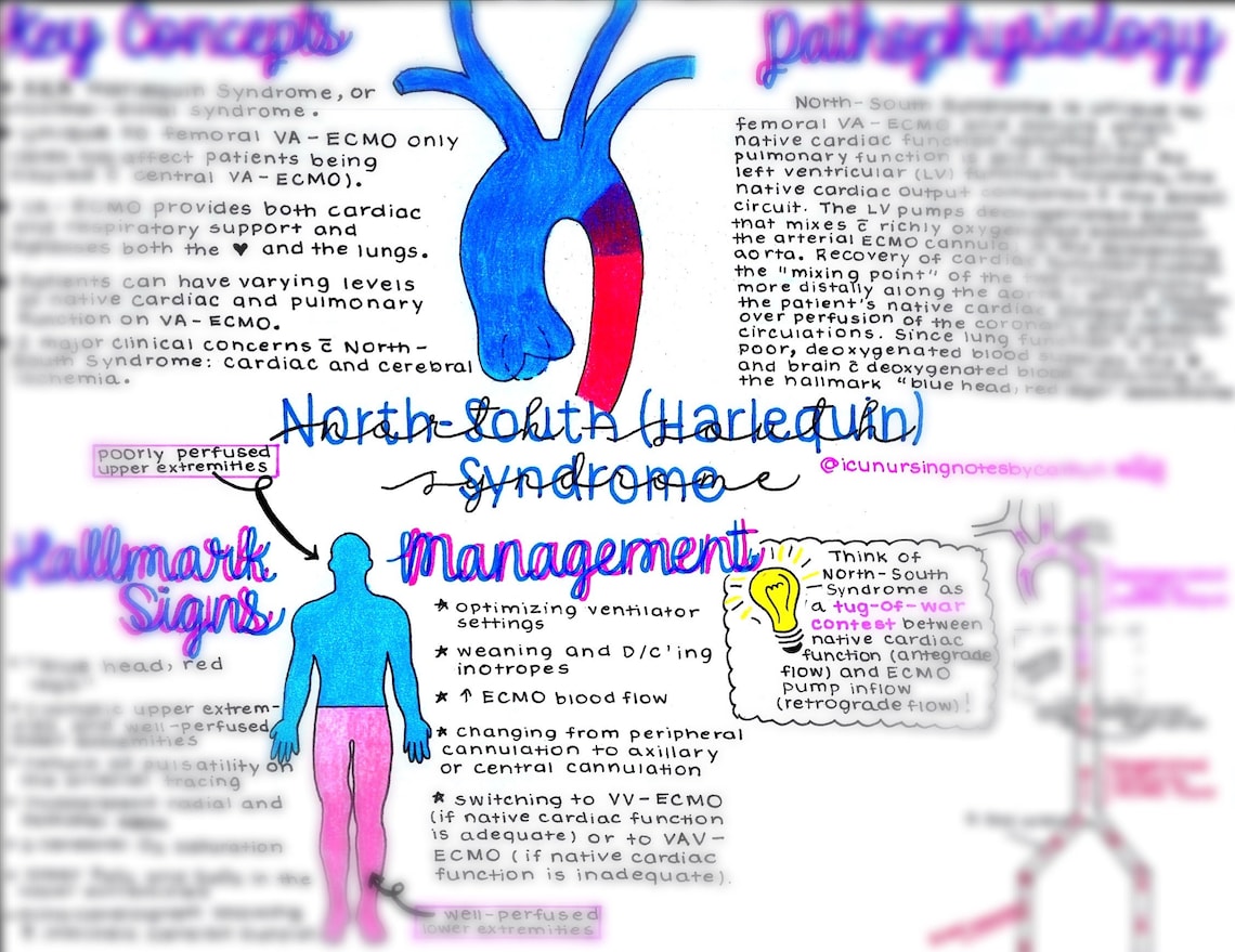 Extracorporeal Membrane Oxygenation ECMO - Etsy