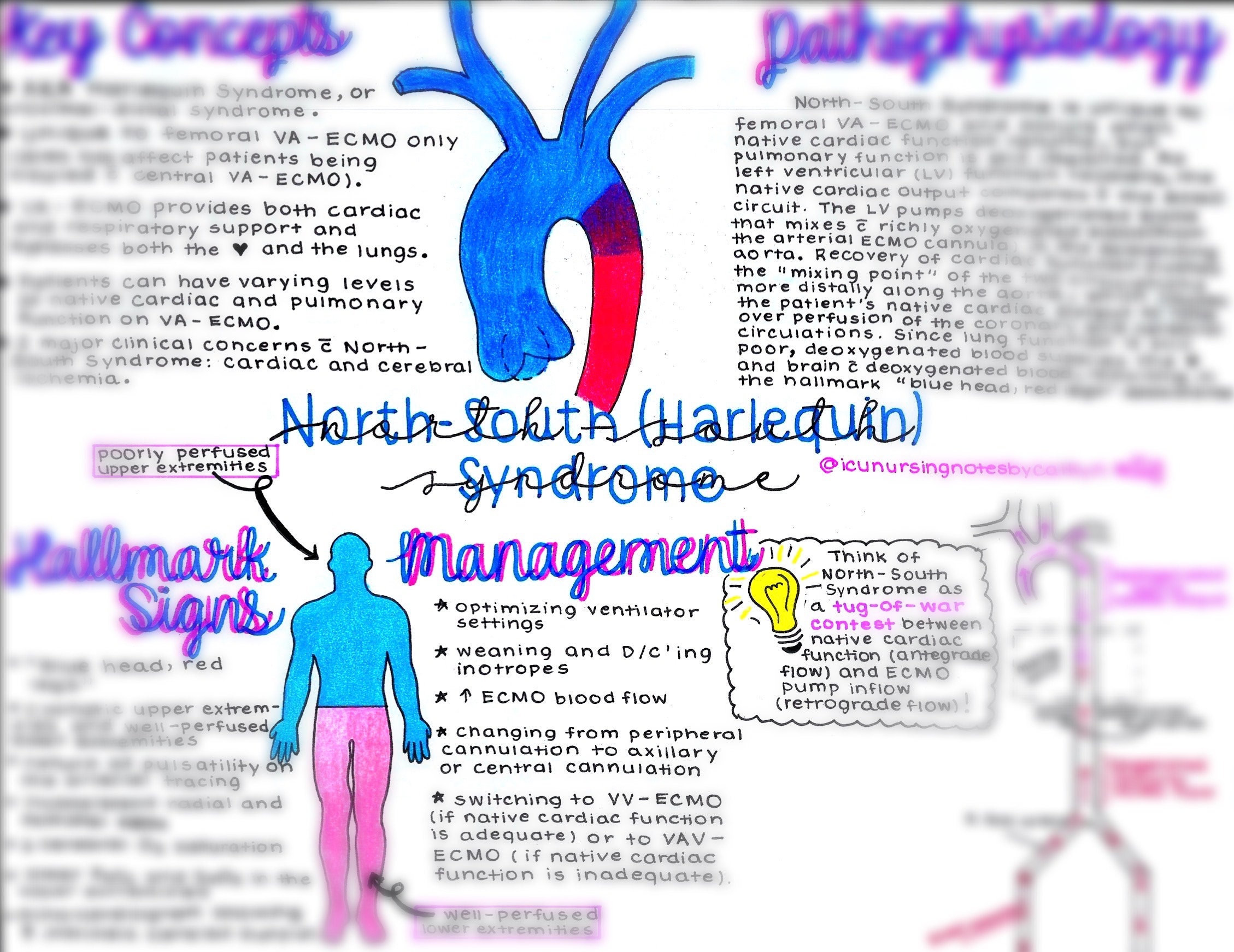 Extracorporeal Membrane Oxygenation (ECMO) - Etsy Denmark