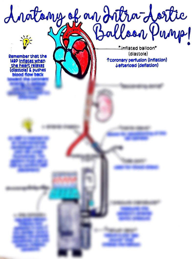 Intra-aortic Balloon Pump (IABP) Anatomy - Etsy