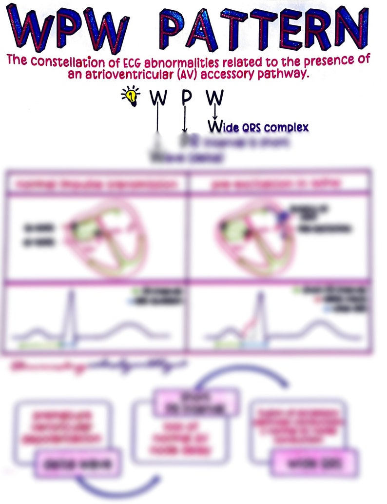 Wolff-parkinson-white Syndrome & Pattern - Etsy