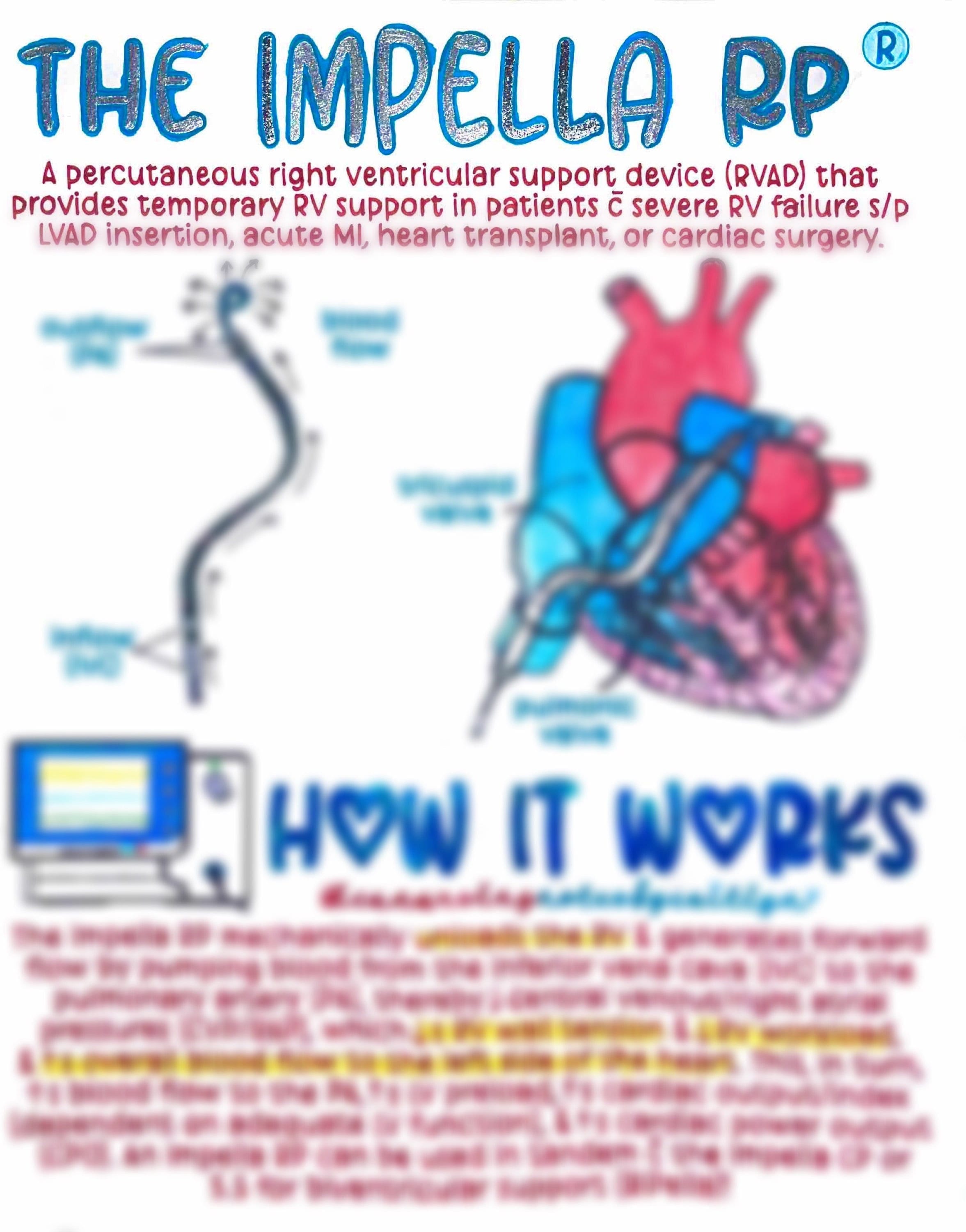 The Impella RP® & Waveforms - Etsy