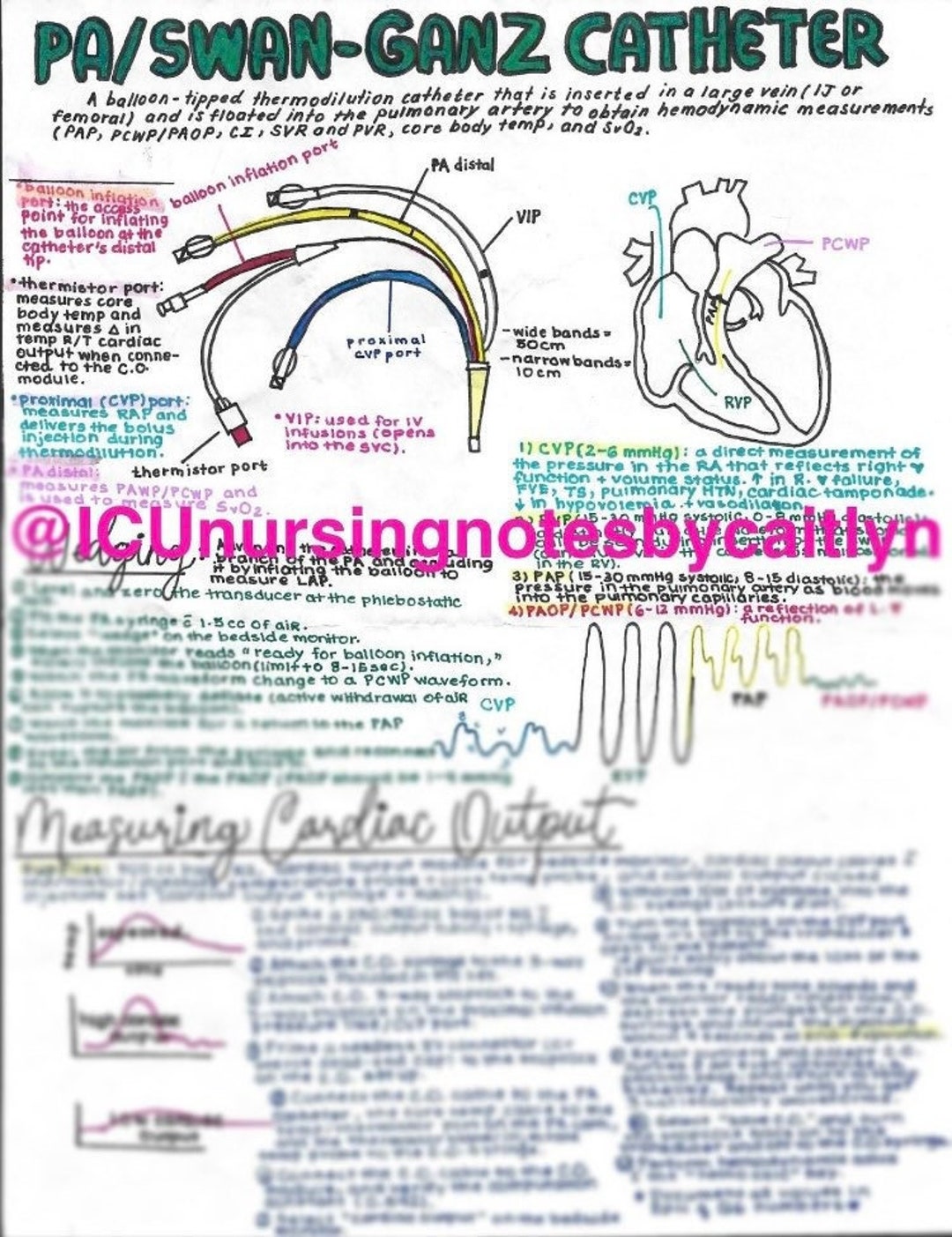 Anatomy of a Swan-ganz/pulmonary Artery Catheter (PAC) & Thermodilution ...