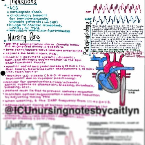 Intra-aortic Balloon Pump IABP Waveforms - Etsy