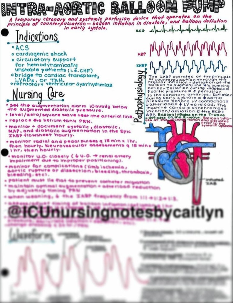 Intra-aortic Balloon Pump - Etsy