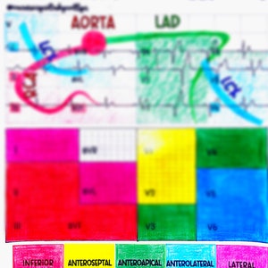 12 Lead ECG Territories - Etsy