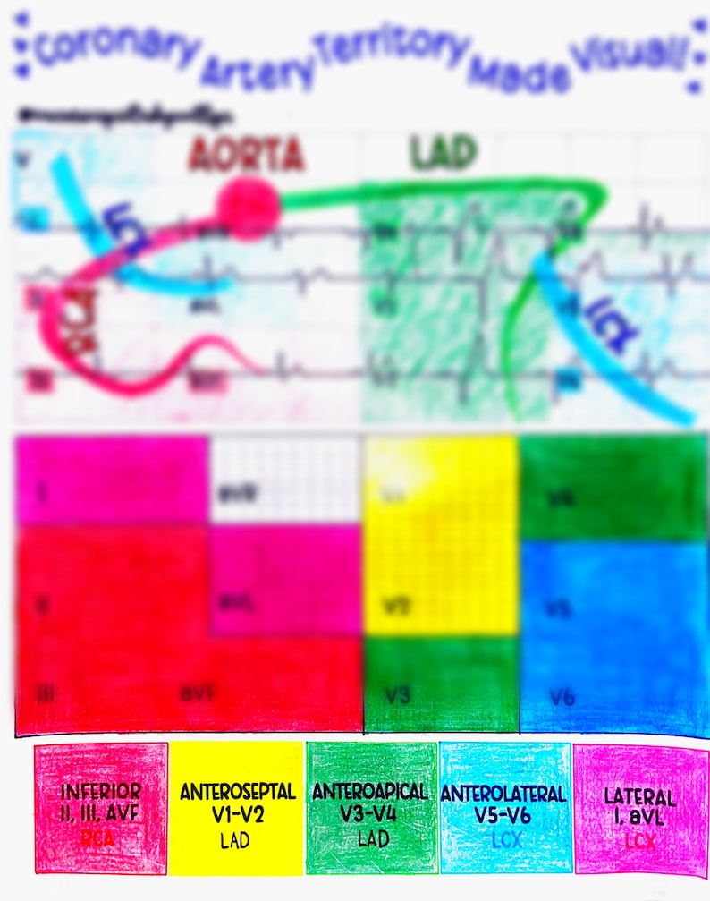 12 Lead ECG Territories - Etsy
