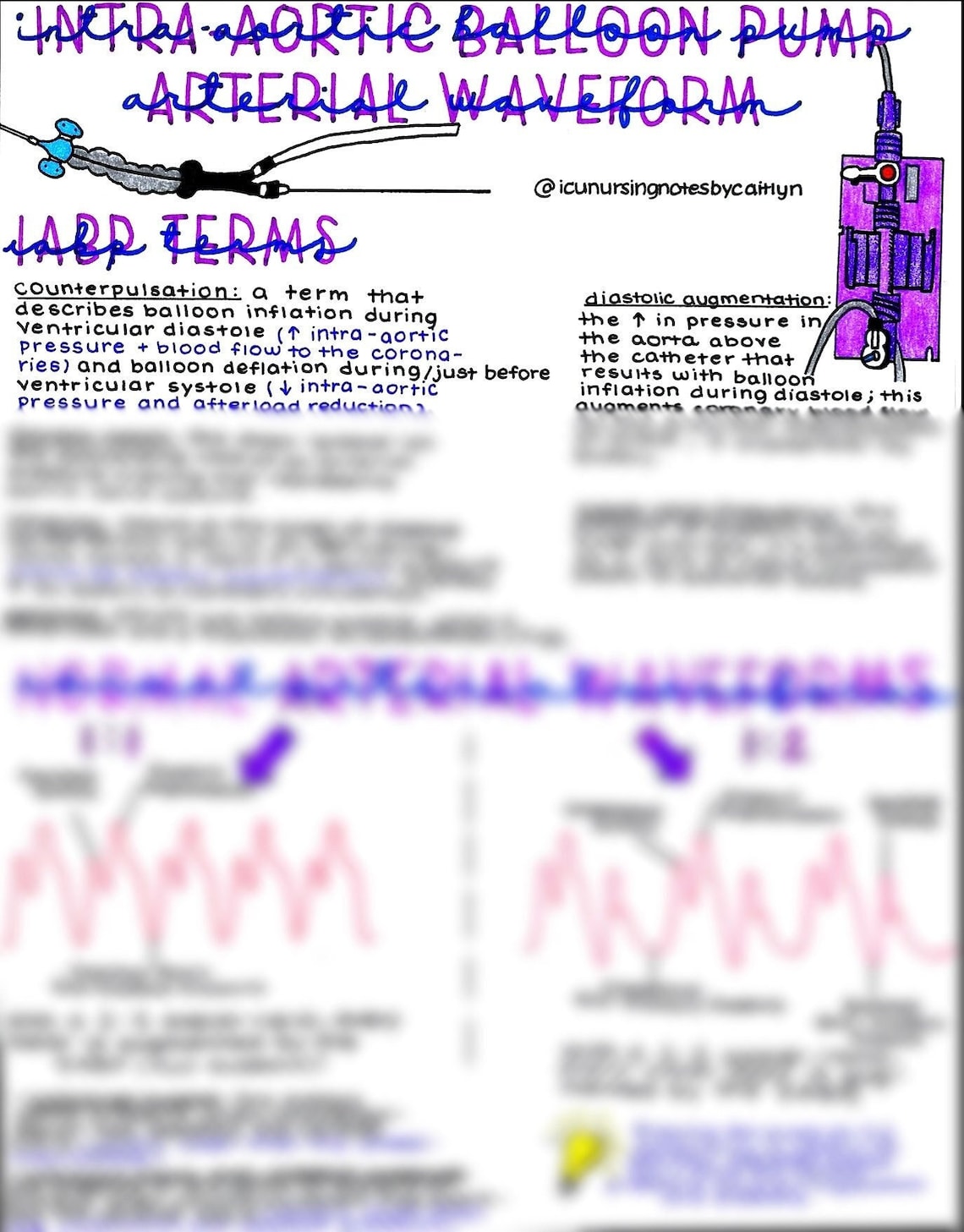 Intra-aortic Balloon Pump (IABP) Waveforms - Etsy